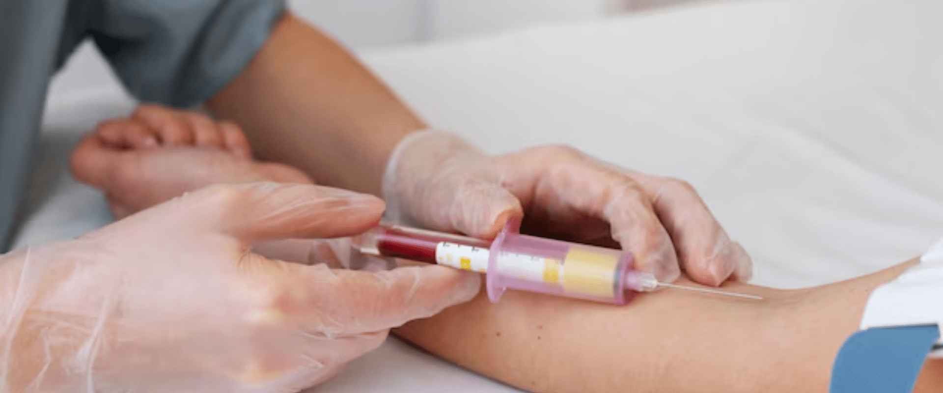 Best Hospital for BVS Stents in Chennai | Dr Harikrishnan Cardio